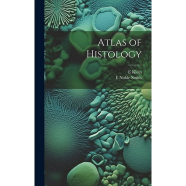 Atlas of Liver Pathology: A Pattern-Based Approach, (Hardcover ...