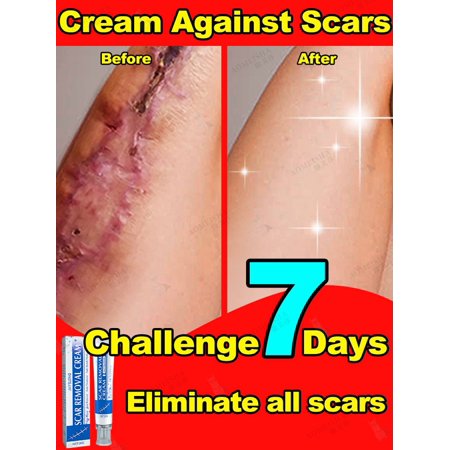 Scar removal cream hyperplastic scars scar gel scar repair burn cae ...