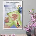 Anatomical Poster Female Urinary Incontinence Posters Wall Art Poster ...