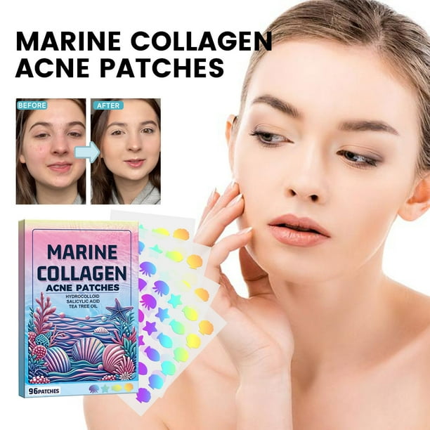 Parches medicinales para el acné para todo tipo de piel, adhesivos para ...