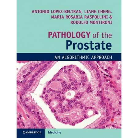 Pathology of the Prostate: An Algorithmic Approach | Walmart Canada