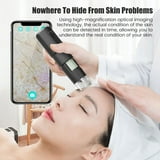 Wireless Skin Analyzer Machine Dermatoscope Scalp/Skin/Hair follicle ...