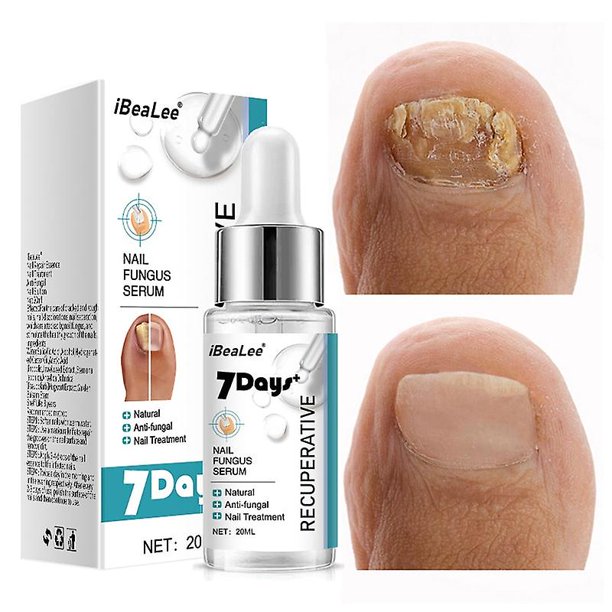 7days Repair Nail Fungus Treatments Essence Foot Care Serum Toe Nails Fungal Removal Gel Anti ...