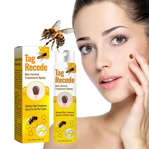 Spray For Skin Tags Recede And Tags Spray For All Skin Types Cleansing ...