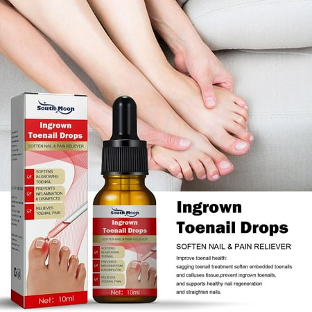 Ingrown Toenails - Ingrown Toenail Pain Relief and Softener Kit, 10ml ...