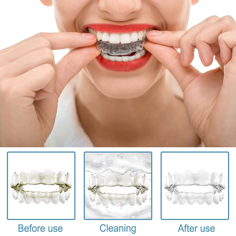 Dental Appliance Cleaner Dental Retainer Cleaner Foam Stain Remover ...