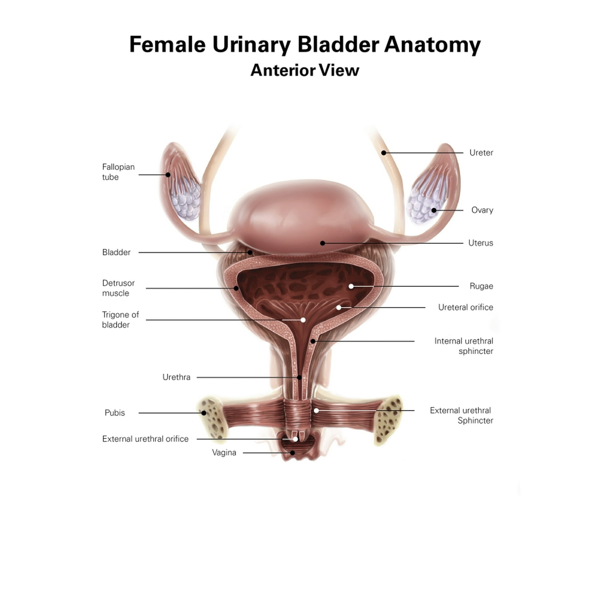 Bladder Dissection