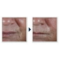 RoC Retinol Correxion Targeted Deep Facial Wrinkle Patches, 6 Ct ...