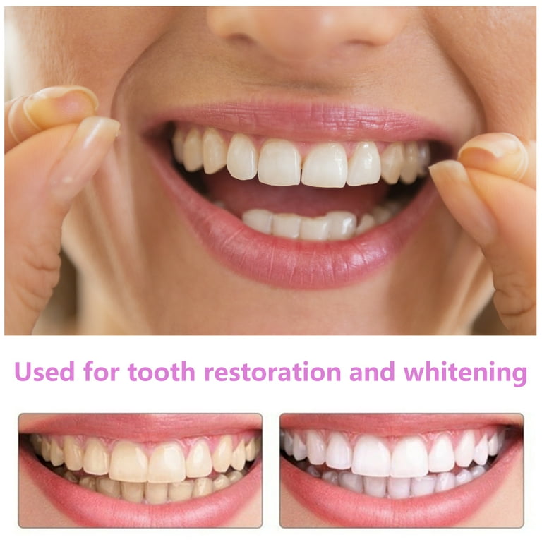 Removable Teeth Covers