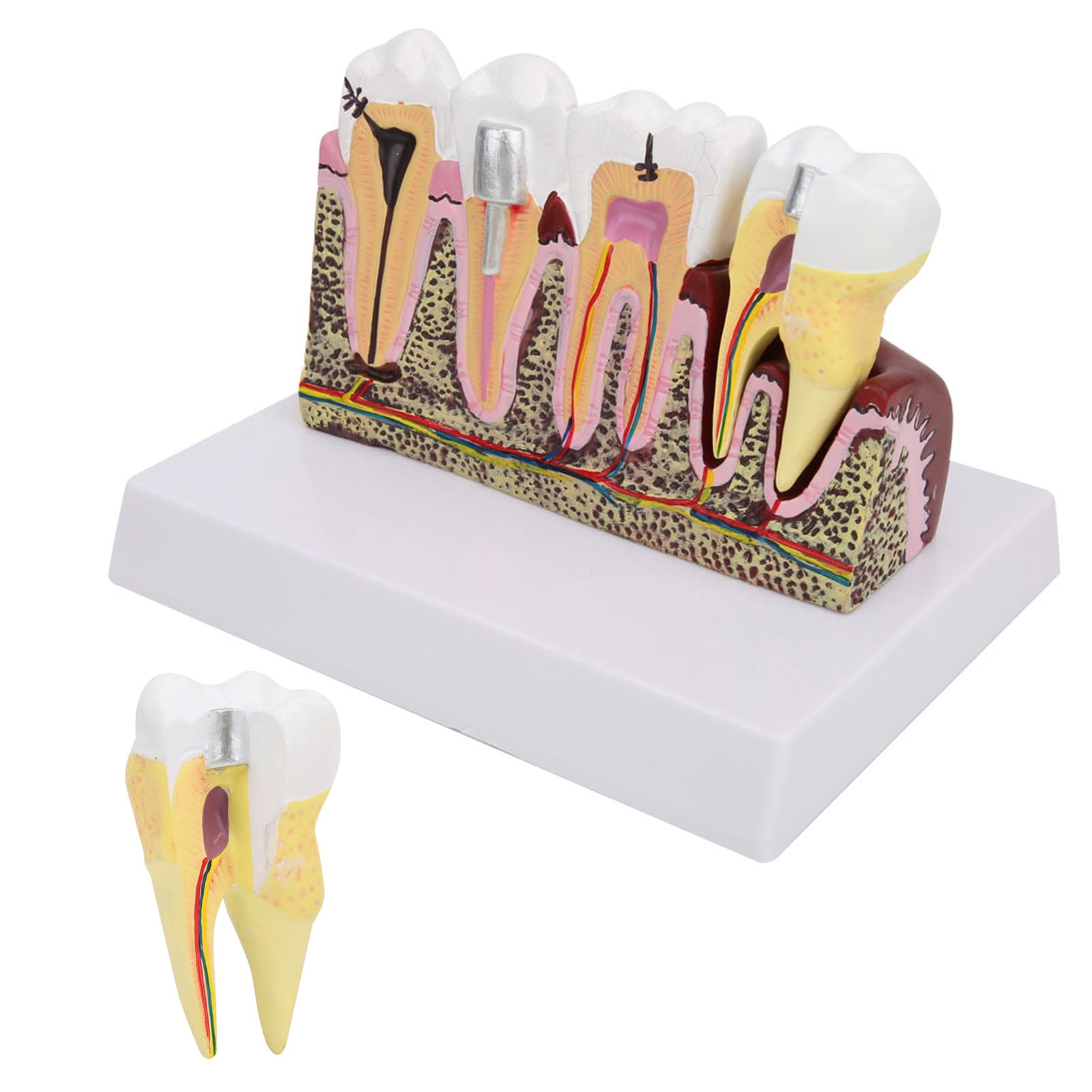 Modelo dental, modelo de dientes dentales, modelo anatómico de dientes ...