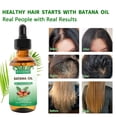 Batana Oil for Hair Growth & Skin Care 2.02 Fl oz - 100% Pure Natural ...