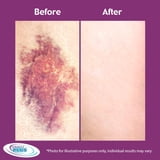 Miracle Plus Arnica Healing and Swelling Relief Bruise Cream, 4 oz ...