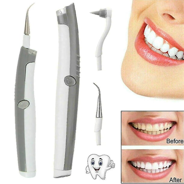 Electric Ultrasonic Tooth Cleaner Oral Teeth Stain Dental Cleaning ...