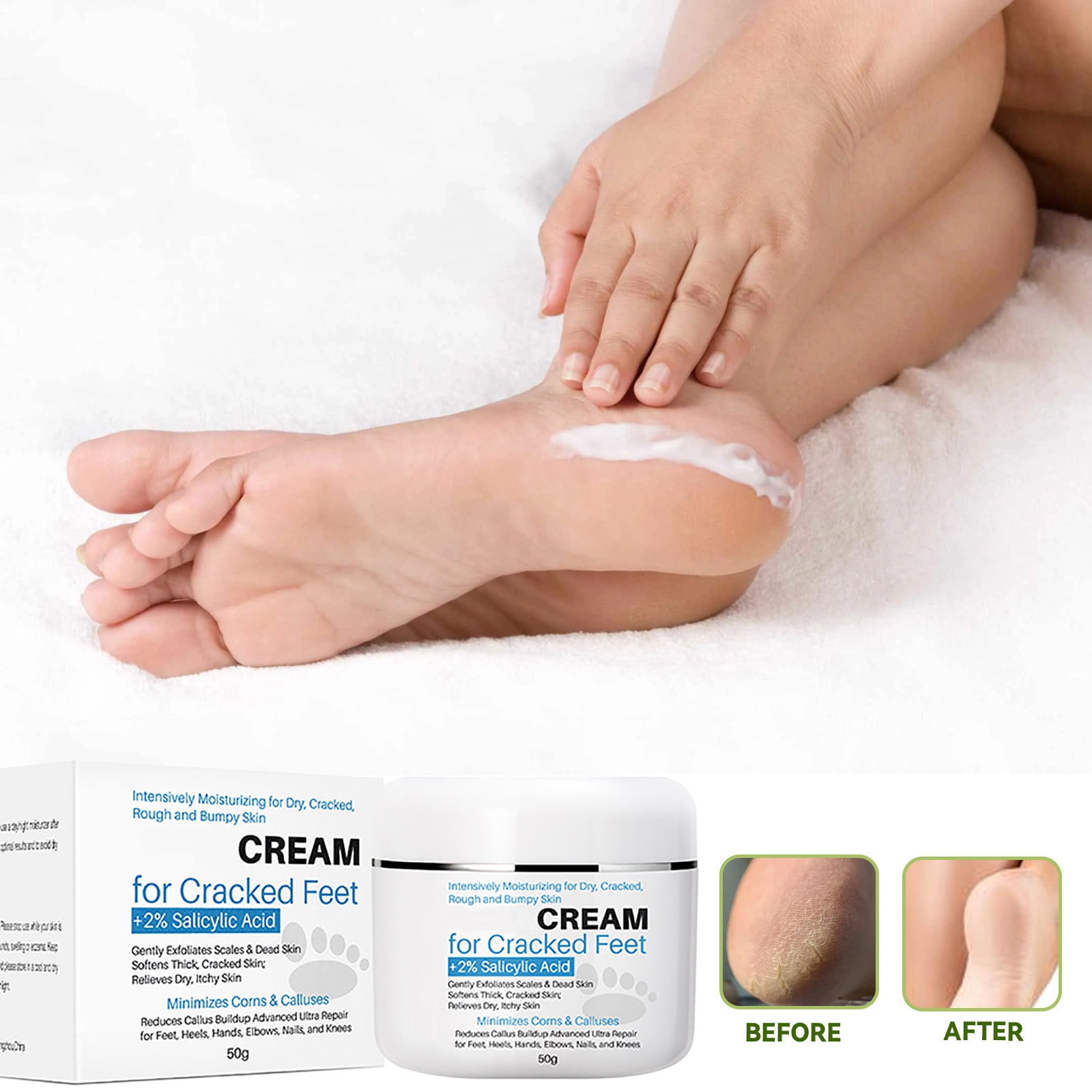 Crema para pies agrietados, hidratante y minimiza callos y durezas (50 ...
