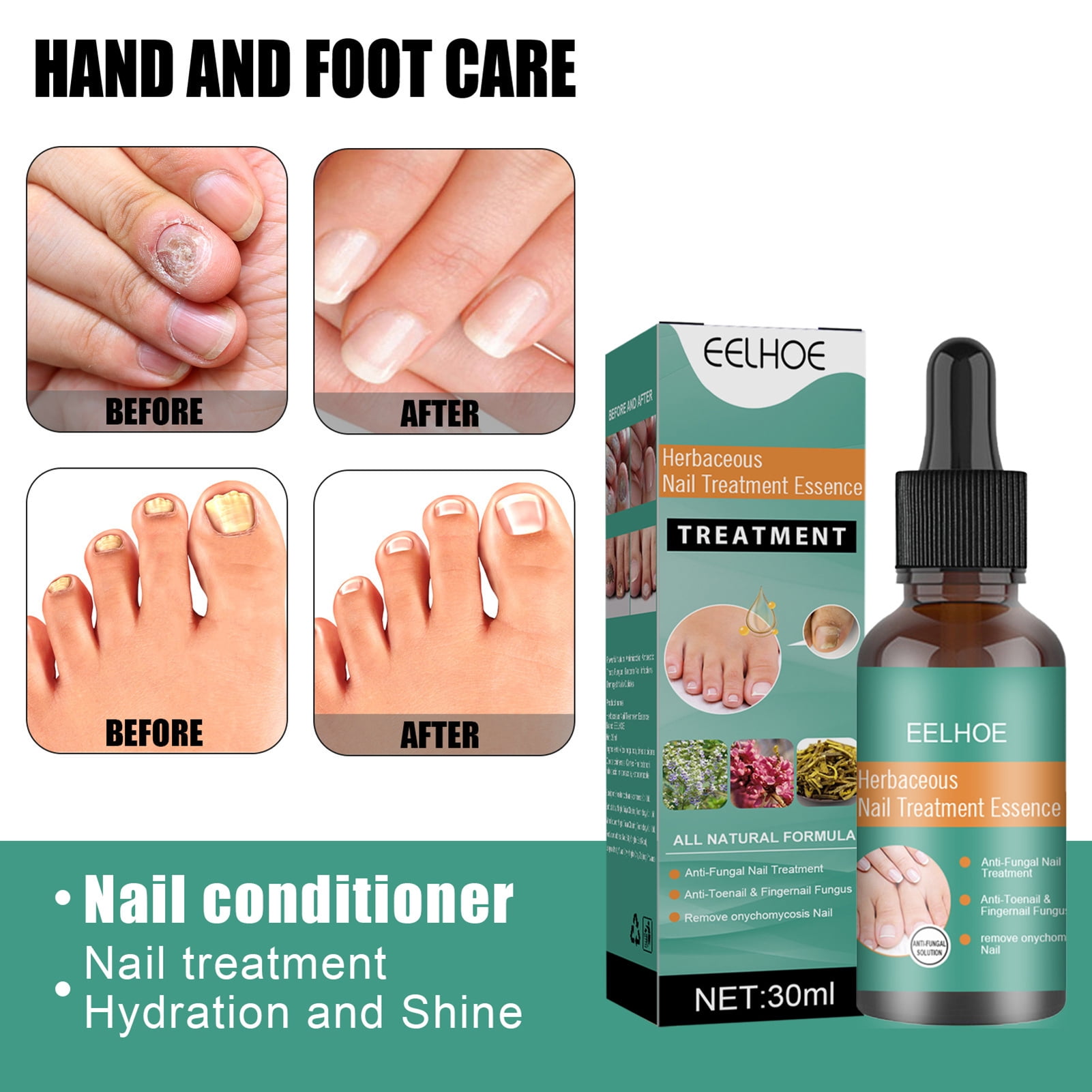 Travelwant 30ml Extra Strength Toenail Fungus Treatment Nail Fungus