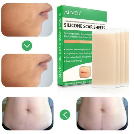 Reusable Silicone Scar Sheets Removal Patch Acne Gel Scar Therapy ...