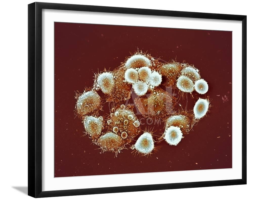 HeLa Cells, SEM, Figurative Framed Art Print Wall Art by Science Photo ...