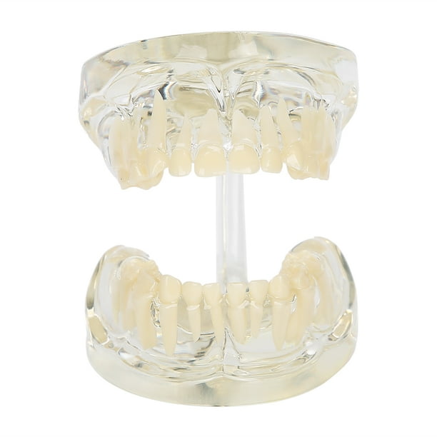 Deciduous Teeth Model,Dental Deciduous Teeth Model Teeth Model Dental ...