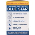 Blue Star Ointment, Anti-Itch Medicated Ointment for Eczema, Insect ...