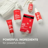 Neutrogena Stubborn Acne Spot Drying Treatment, 10% Sulfur, Overnight ...