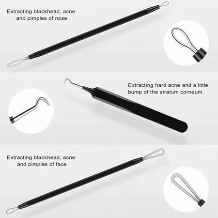 Stainless Steel Blackheads Squeeze Tweezers Needle Kit Double-end Acne ...