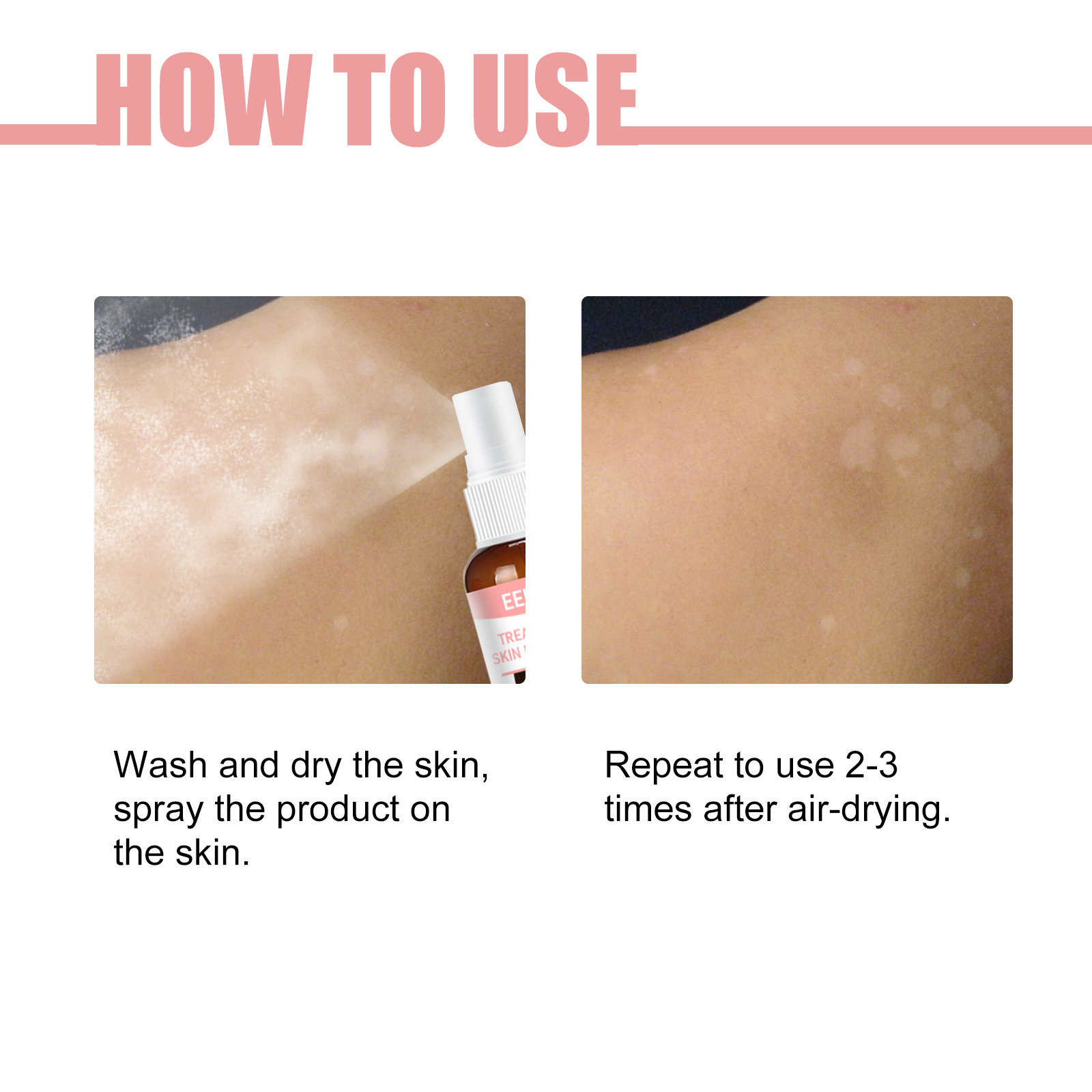 Buy Vitiligo Cream,Vitiligo Care Cream,Pigmentation regulating ...