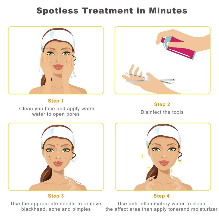 Blackhead Removal Tips