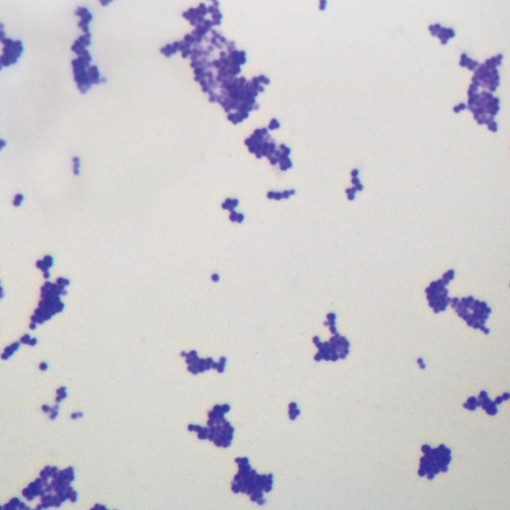 Staphylococcus Aureus Slide, W.M. - Walmart.com