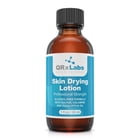 Bye Bye Blemish Drying Lotion for Acne - 1 Oz (Pack of 3) - Walmart.com