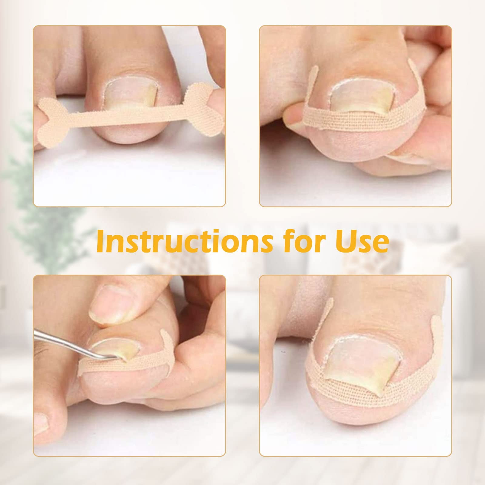 Click here for Becaristey 10 Pieces Ingrown Toenail Adjustment St... prices