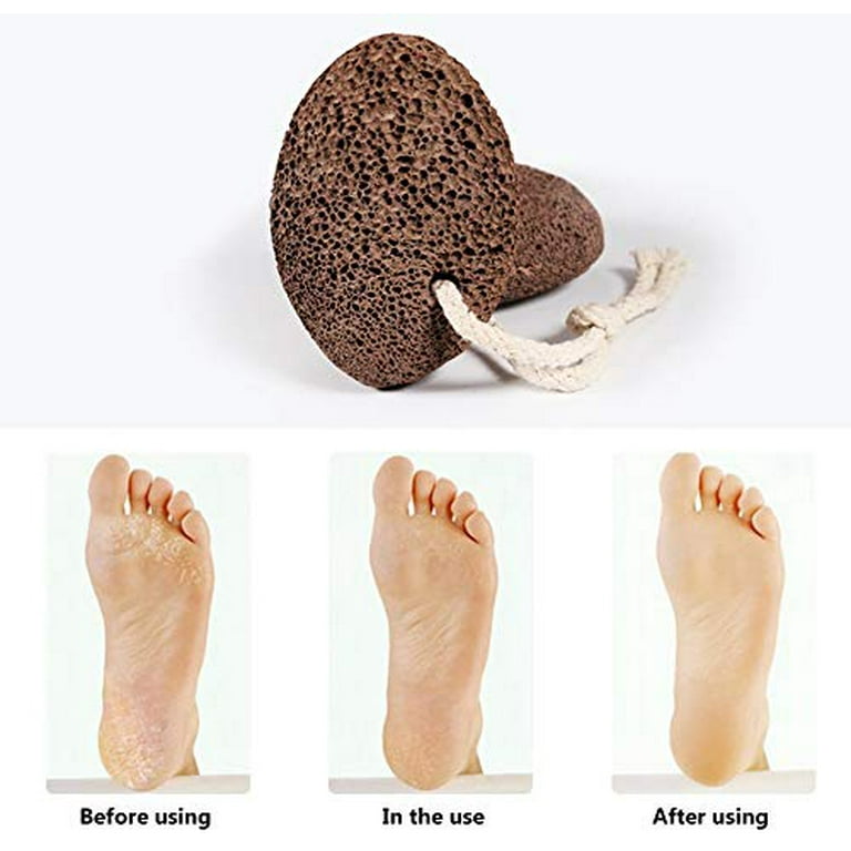 Pumice Stone Before And After