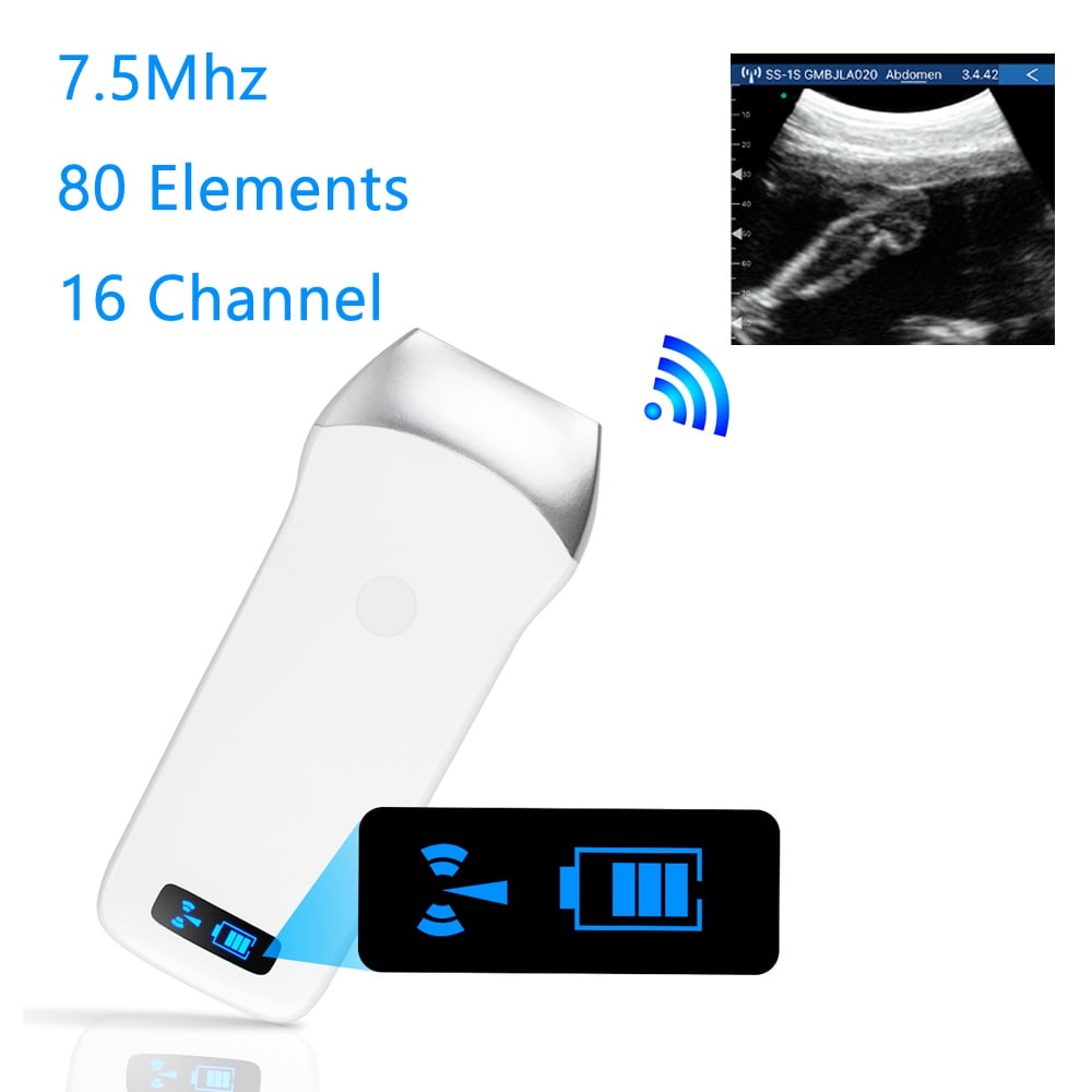 Portable WIFI Wireless Ultrasound Scanner Machine +7.5Mhz Linear Array ...