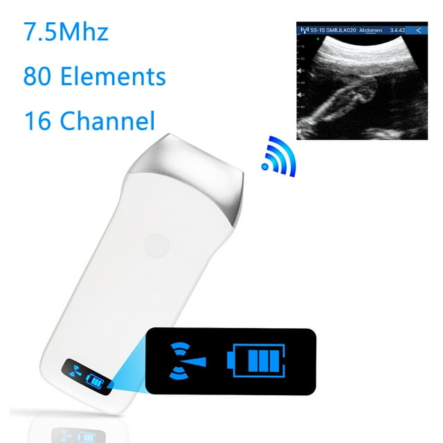 Portable WIFI Wireless Ultrasound Scanner Machine +7.5Mhz Linear Array ...