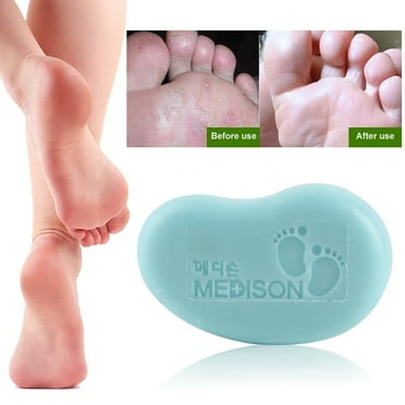 Johnson & Johnson Foot Soap, 4 Ounce - Walmart.com