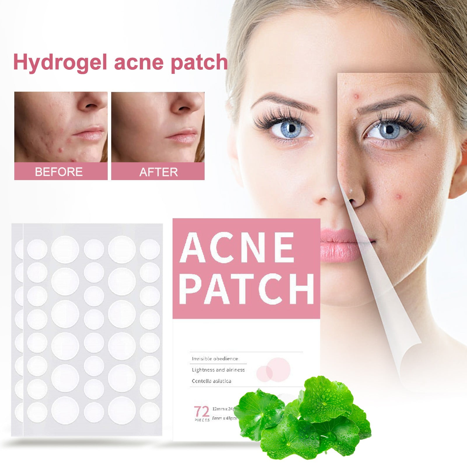 Parche para el acné Parches transparentes para espinillas con ...