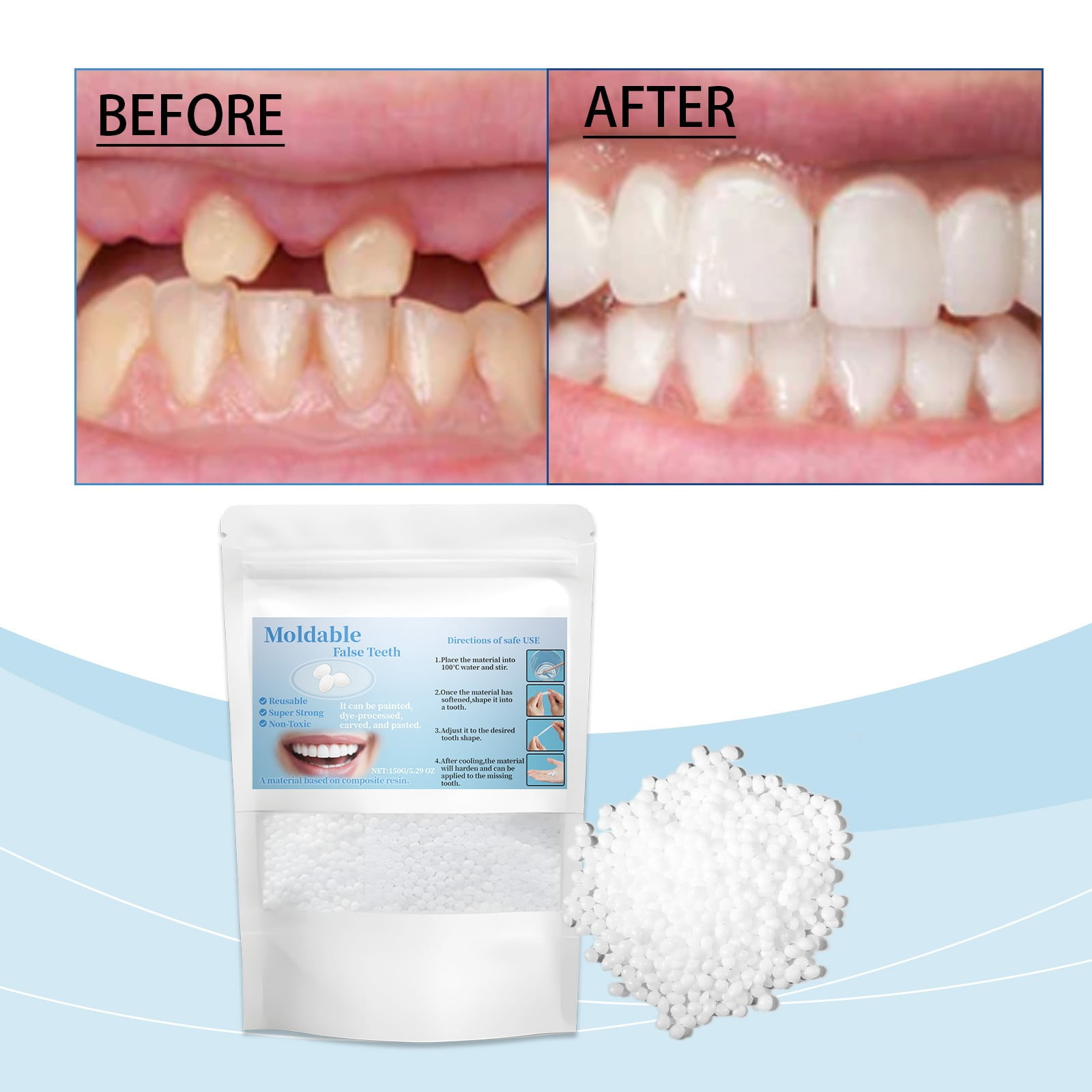 DFC Shapeable Solid Gum To Shape Dentures Beautiful Teeth Easy To The ...