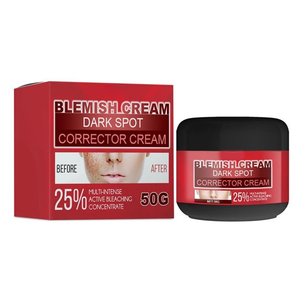 Crema blanqueadora de pecas Crema para pecas Crema blanqueadora hidratante para eliminar manchas ...