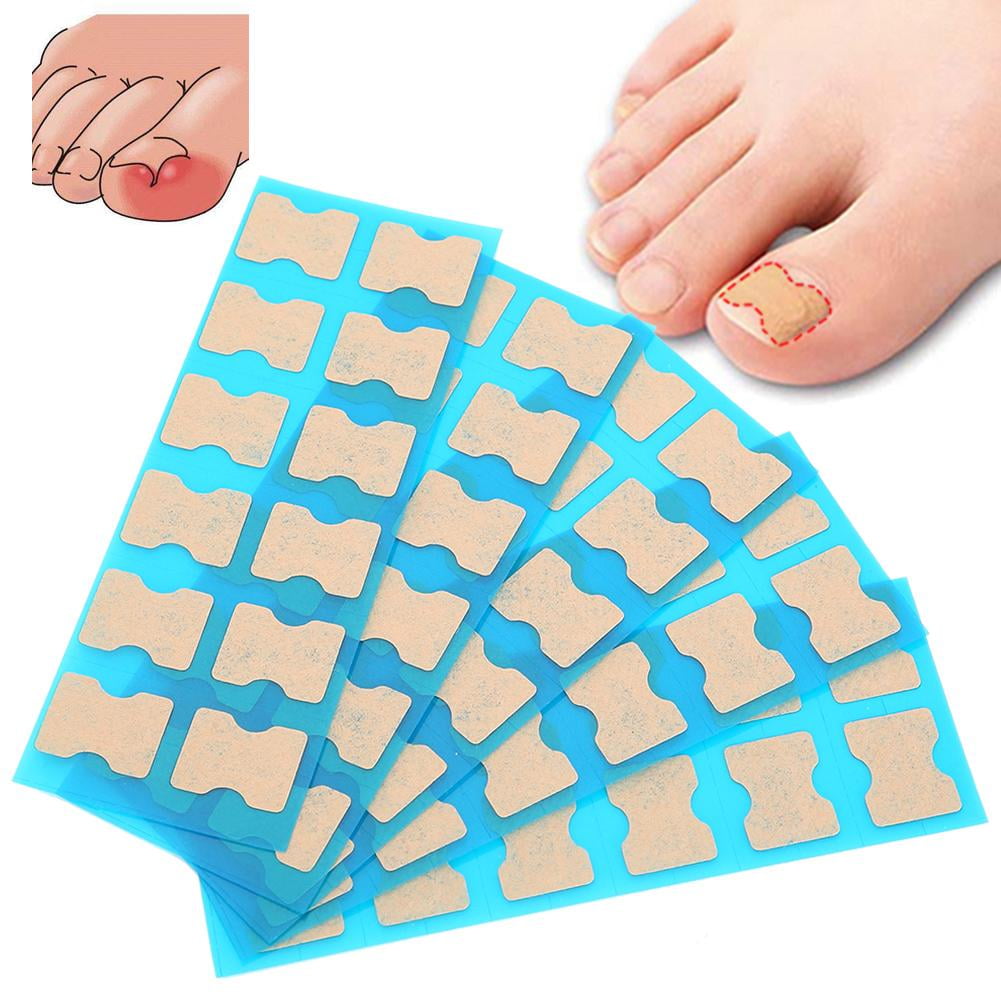 Mgaxyff Foot Care Patch,Toenail Correction Patch,Ingrown Toenail ...