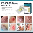 Ceeport Medical Xeroform Dressing 5x9 - Non-Adherent, Fine Mesh Gauze ...