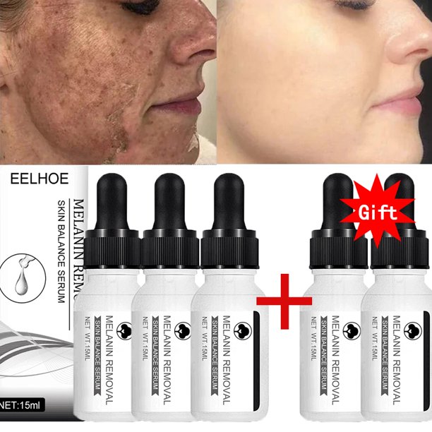 Suero antienvejecimiento para eliminar manchas oscuras, crema blanqueadora de pecas, aclara la ...