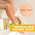 Repair Chicken Skin Cream Curing Body Dark Spots Keratosis Follicle