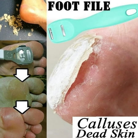 Volkmi 1pcs ABS rubbing foot planing foot skin knife pedicure ...