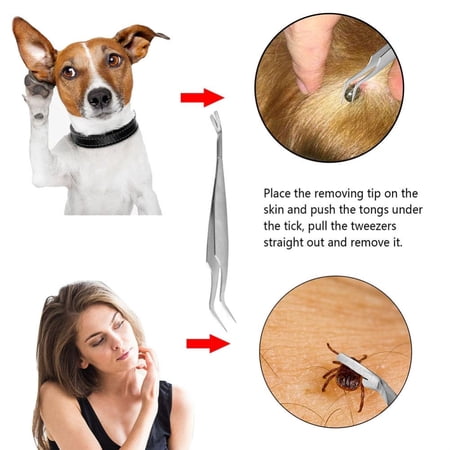 6PCS Tick Tweezers Professional Tick Hook Set Tick Tick Remover Tongs ...
