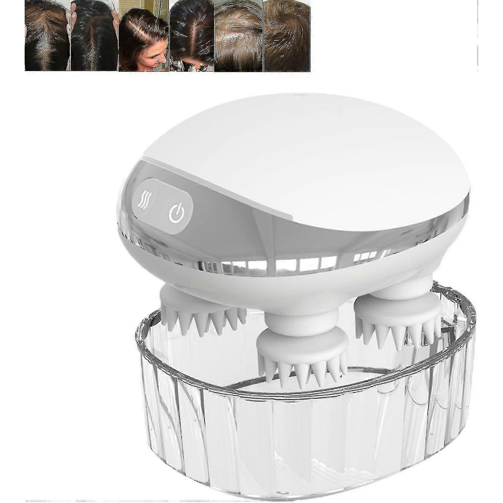 Click here for Muchongchong Scalphero - Smart Scalp Massager With... prices