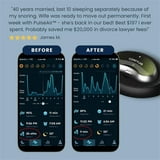 Comfylab Pulseair Anti Snoring Neurostimulation Device, Professional ...