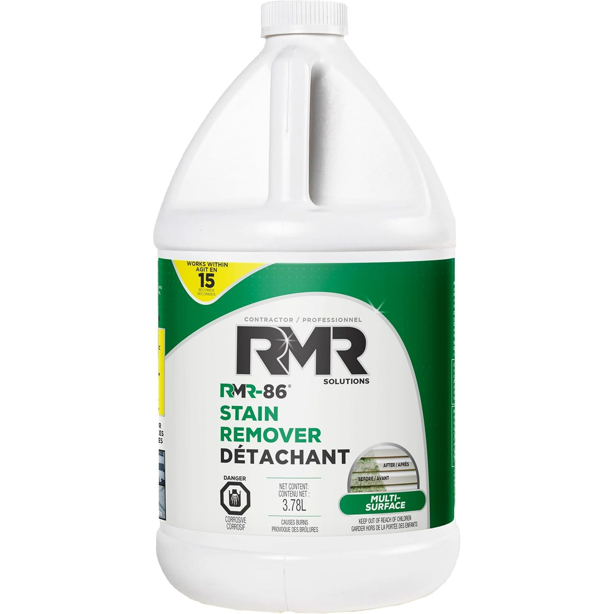 Click here for Yantong Rmr-86 Instant Stain Remover Spray - Scrub... prices