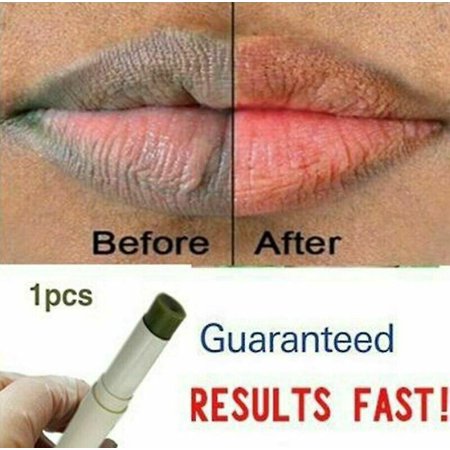 Lips Pink Fresh Fast Lightening Bleaching Cream Balm Treatment Remove ...