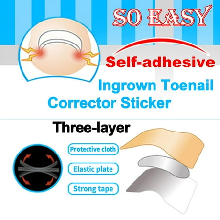 Ingrown Toenail Corrector Stickers Foot Care Stickers Non Glue Toenail ...