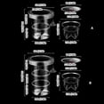 2PCS Fish Breeding Container Floating Breathable Design Isolation Box ...