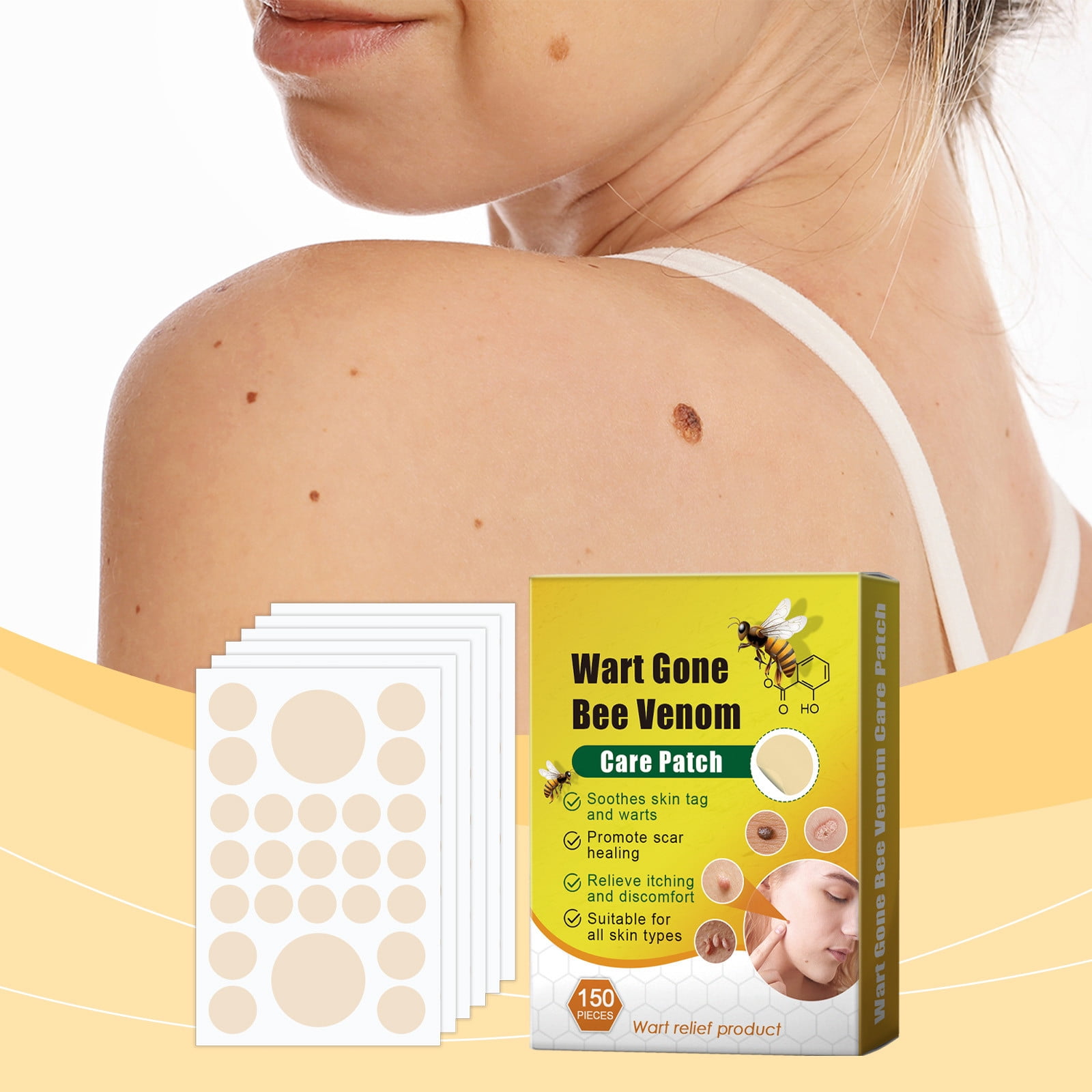 Wart Patch Improves Smooth Skin And Pointed Warts Filamentous Granulation Warts And Child Wart ...